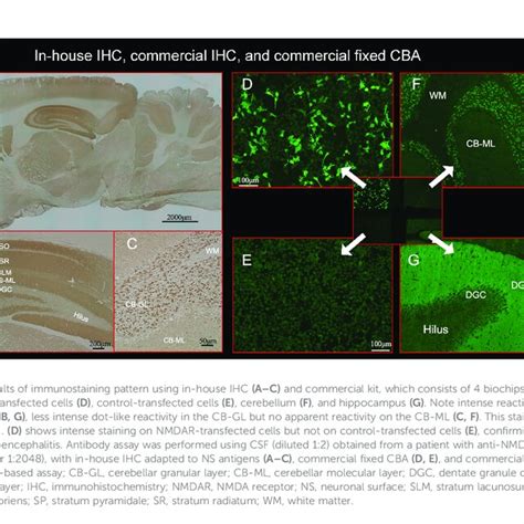 Immunostaining Pattern Highly Characteristic Of Major Neuronal Surface
