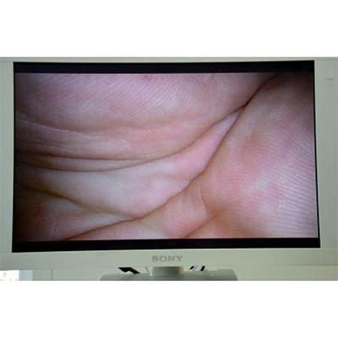 Used Smith And Nephew High Definition Hd Laparoscopic Column With
