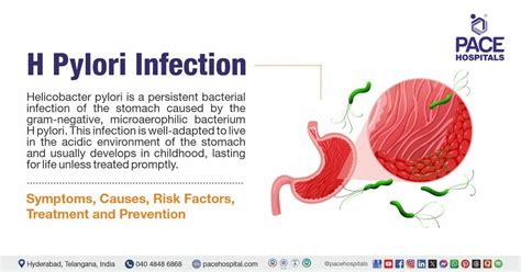 H Pylori Symptoms Test Causes Treatment And Prevention