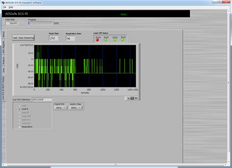 参考译文 Ads1292recg Fe：如何将测量数据保存到文件中ads1x9xecg Fe 演示套件 数据转换器（参考译文帖）read Only 数据转换器（参考译文帖