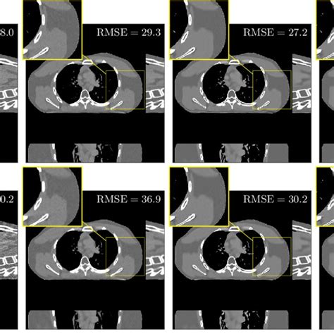 Pdf Sparse View X Ray Ct Reconstruction Using L1 Prior With Learned Transform