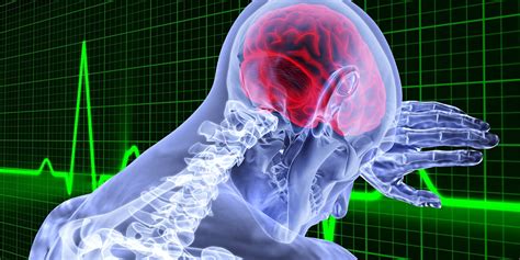 뇌졸중 뇌손상클리닉 한맘플러스 재활의학과의원