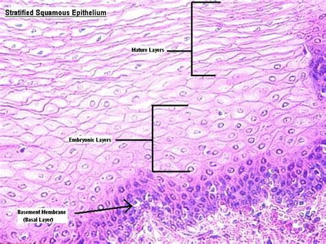 Simple Squamous Epithelium Labeled