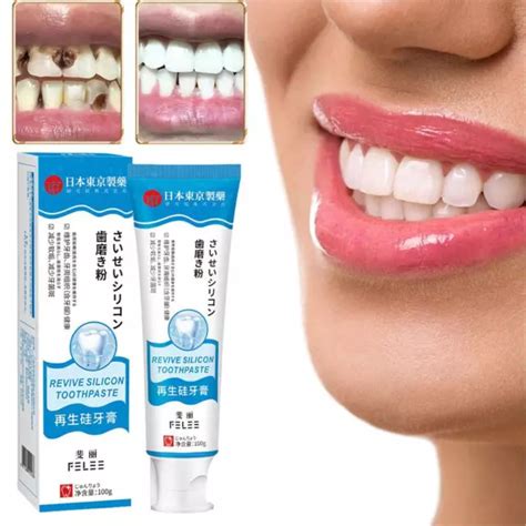 Toothpaste Repair Of Cavities Caries Removal Of Plaque Whiteni Teeth Stains R6d7 Eur 8 66