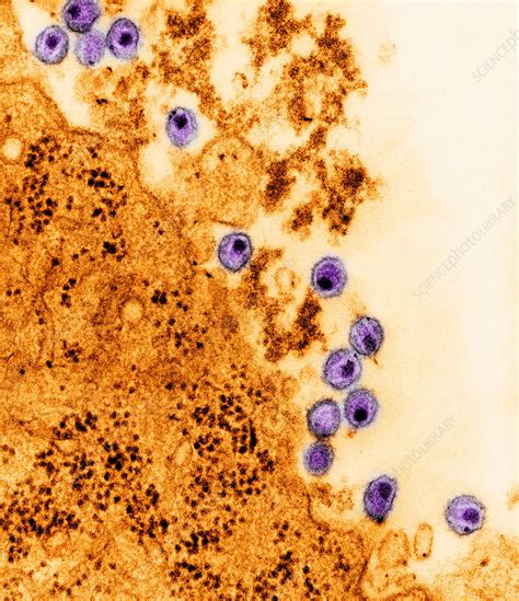 Electron Micrograph Of Hiv Virus Stock Image F018 9136 Science Photo Library