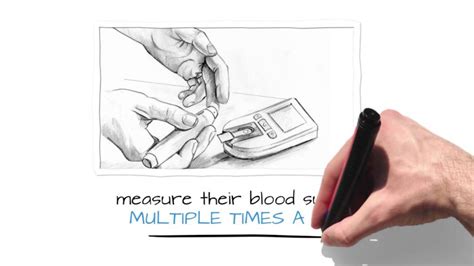 Insulin Algorithms Insulin Dosing Made Easy Video