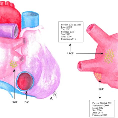 Division Of The Cardiac Ganglionic Plexus By Electrophysiologist Download Scientific Diagram
