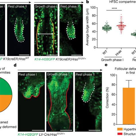 Tissue Correction Occurs In Mutant Hras Model K14 H2bgfp Labels