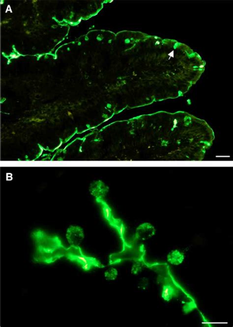 Localization Of Lectin Pna By Fluorescence Microscopy A A Distinct