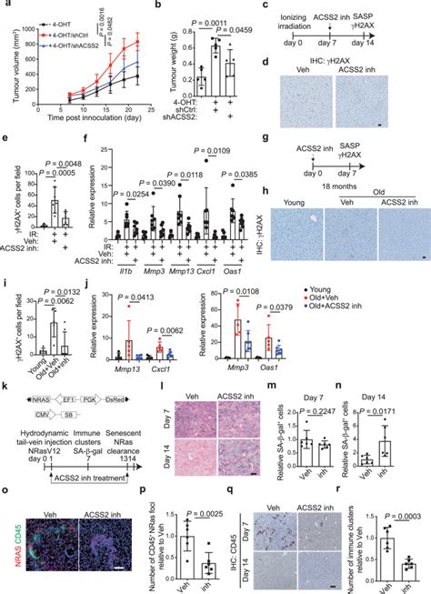 Acss2 Drives Senescence Associated Secretory Phenotype By Limiting