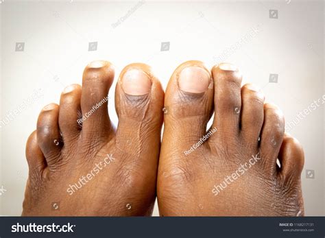 African American Feet