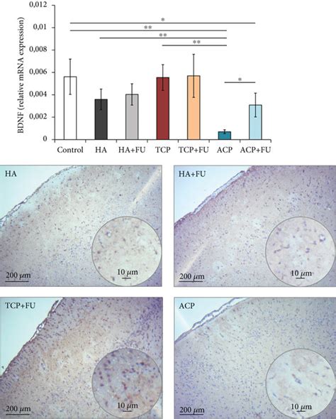 The Relative Gene Expression And The Immunohistochemical Expression Of