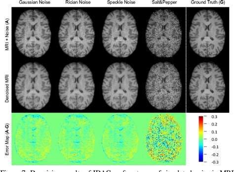 Figure 7 From Iterative Learning For Joint Image Denoising And Motion Artifact Correction Of 3d