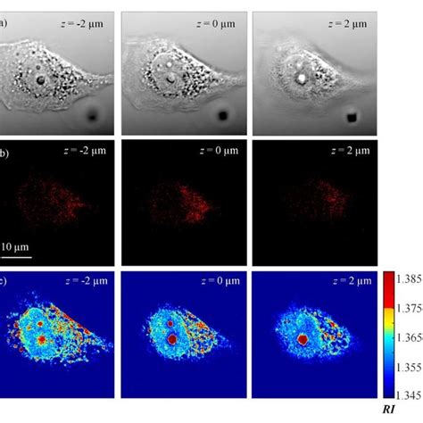 Pdf Label Free High Resolution 3 D Imaging Of Gold Nanoparticles Inside Live Cells Using