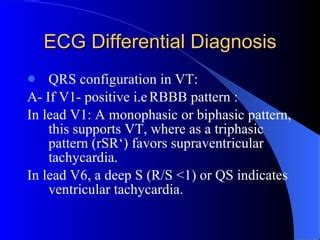 Systematic Approach To Wide Qrs Tachycardia PPT