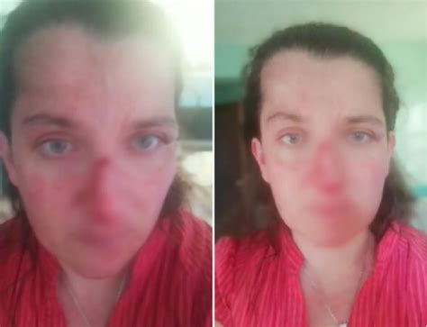 Психично болен мъж преби сестра си в дома ѝ в Бургас снимки