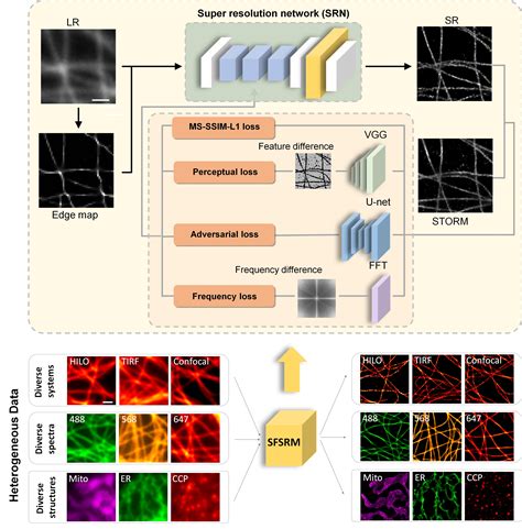 Single Frame Deep Learning Super Resolution Microscopy A New Era For Intracellular Dynamics