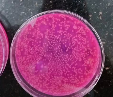 Anas Pulikkal On Linkedin Enumeration Of Bacillus Cereus From Food By