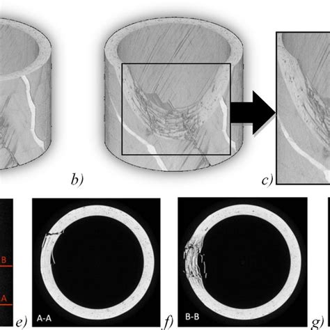 A B C 3d Volume 3d Micro Ct Reconstruction D E F Cross Download Scientific Diagram