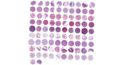 bcn921a multiple 10 types organ normal tissue array 69 cases 92 cores
