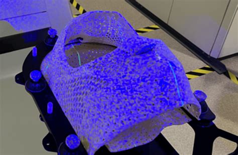 Initial Experience Of Implementing A Pre Treatment Dry Run For Hyperarc