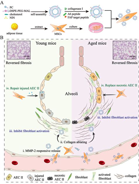Sci Adv 姜虎林团队发表肺纤维化最新研究成果