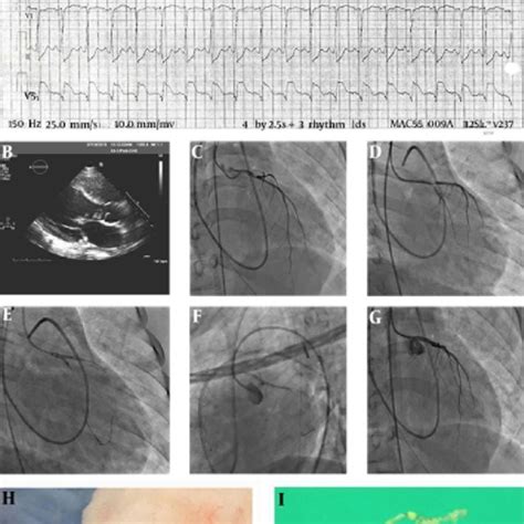 The Flowchart Of The Sov Detection And Cropping Algorithm Download
