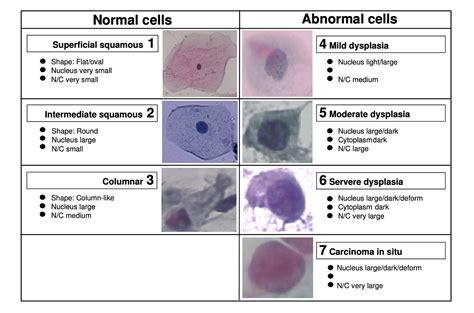 Herlev Pap Smear Image Classification Part 1 2019 Fastai Course