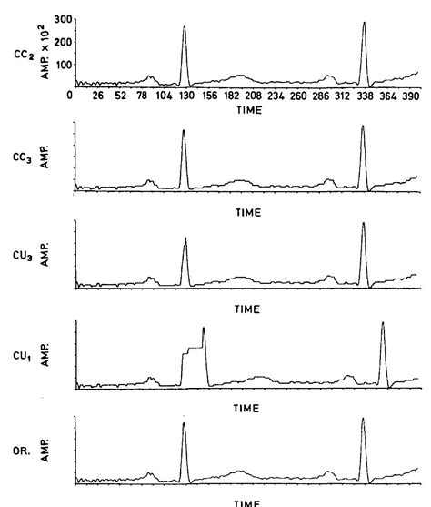 Examples Of Reconstructed Ecg Analogue Waveforms Cu