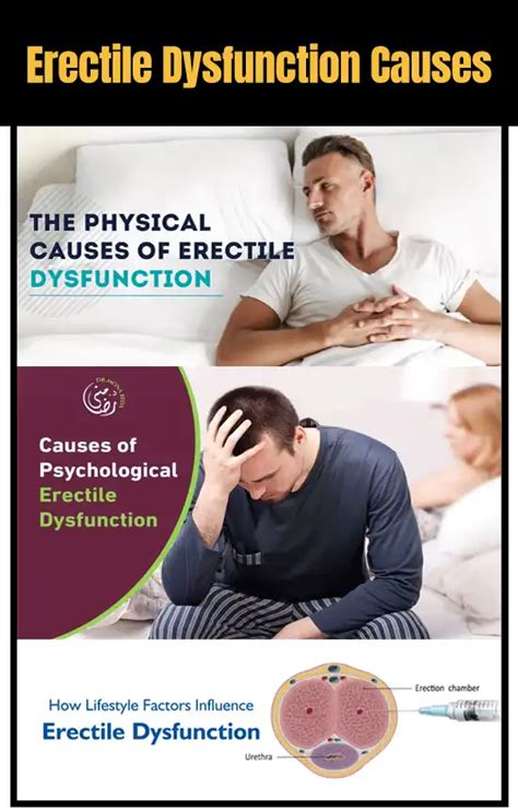 Erectile Dysfunction Symptoms Causes And Treatment Options
