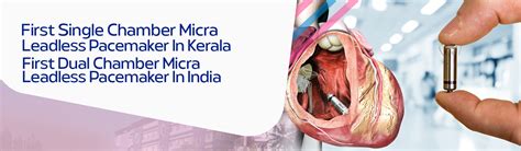First Single Chamber Micra Leadless Pacemaker In Kerala First Dual