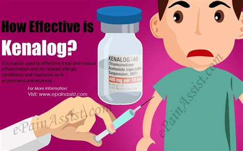 How Effective Is Kenalog And What Are Its Side Effects