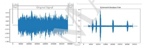 Signal And Butterworth Bandpass Filter Applied To The Sign