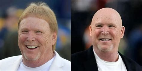 Explained Mark Davis Haircut Truth Hair System
