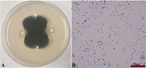 Figure 2 From Isolation And Characterization Of Paenibacillus Polymyxa