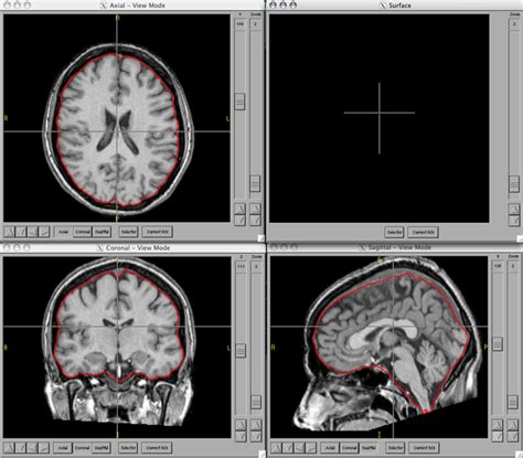 BRAINSCut NAMIC Wiki