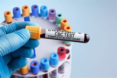 How To Interpret CBC Results A Comprehensive Guide