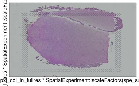 A Ggplot Layer For Visualizing The Visium Histology Geom Spatial SpatialLIBD