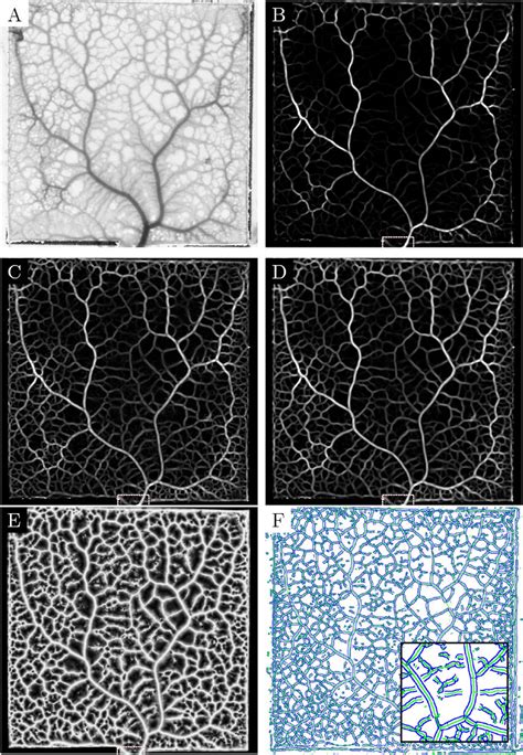 automated analysis of a physarum network evacuating from a 10×10 mm