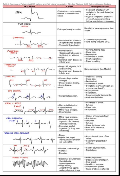 Ecg Cardiology Intern Resident Generalpractitioner Ecfmg Usmle