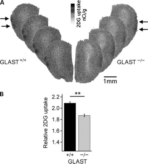 Odor Induced 2dg Uptake In Olfactory Glomeruli A Download Scientific Diagram
