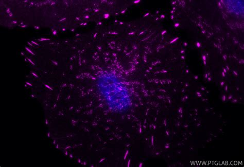 Integrin Alpha V Antibody Cl647 84883 5 Proteintech