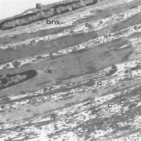 Section From A Control Graft Showing Thickened Subendothelial Layer Download Scientific Diagram