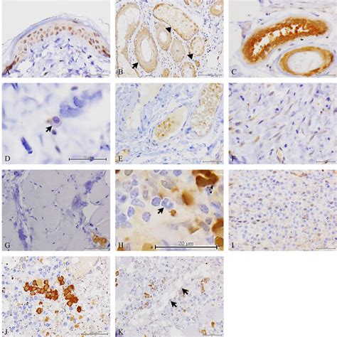 The Staining Properties Of Peroxiredoxin Prdx 1 And 2 In The Newly Download Scientific
