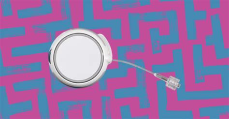 History Of The Dexcom Cgm Revolutionizing Glucose Management Connected In Motion