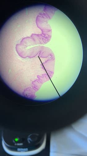 Bio 314 Female Reproductive System Flashcards Quizlet