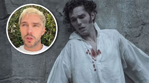 ¿no Puede Caminar ¿por Qué Nicholas Hoult Se Sometió A Una Cirugía