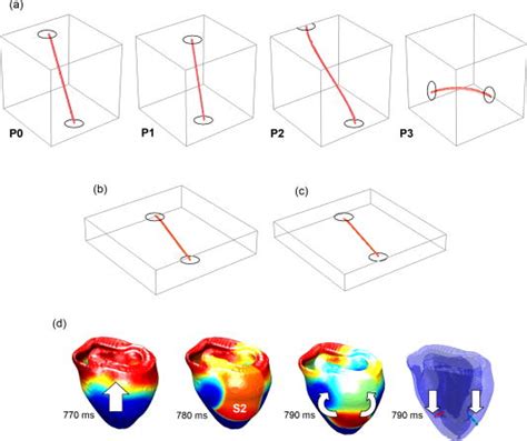Vortex Filament Dynamics In Computational Models Of Ventricular Fibrillation In The Heart