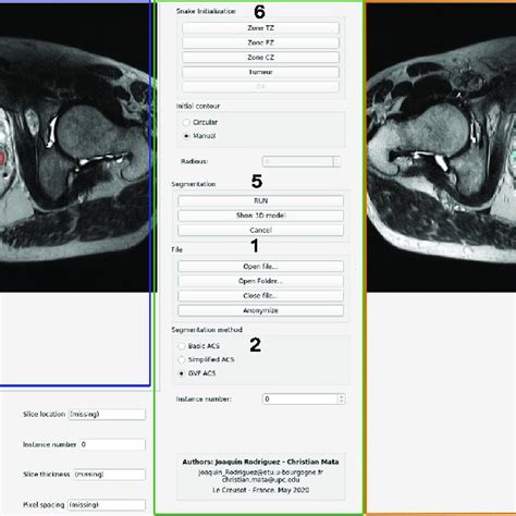 gui interface of the developed active contour segmentation tool using a