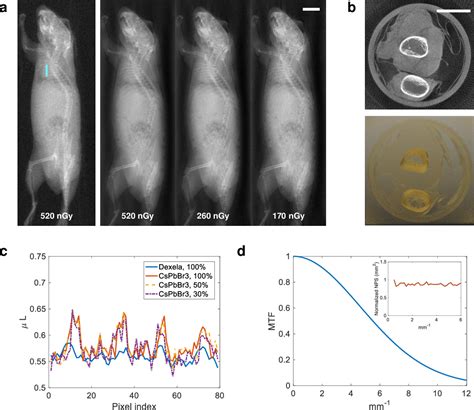 Figure 1 From Cmos Based High Resolution Dynamic X Ray Imaging With